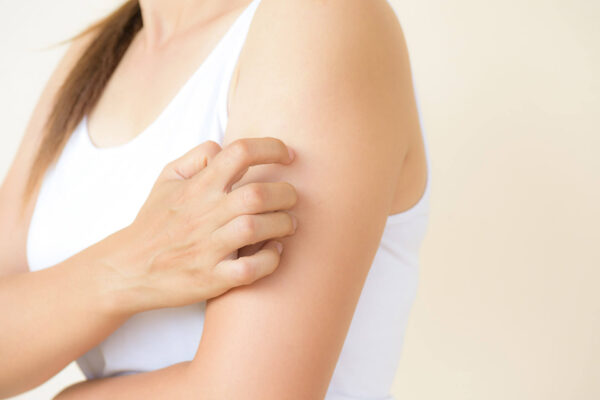 Allergiska utslag: Symptom, orsaker och behandling | Locobase